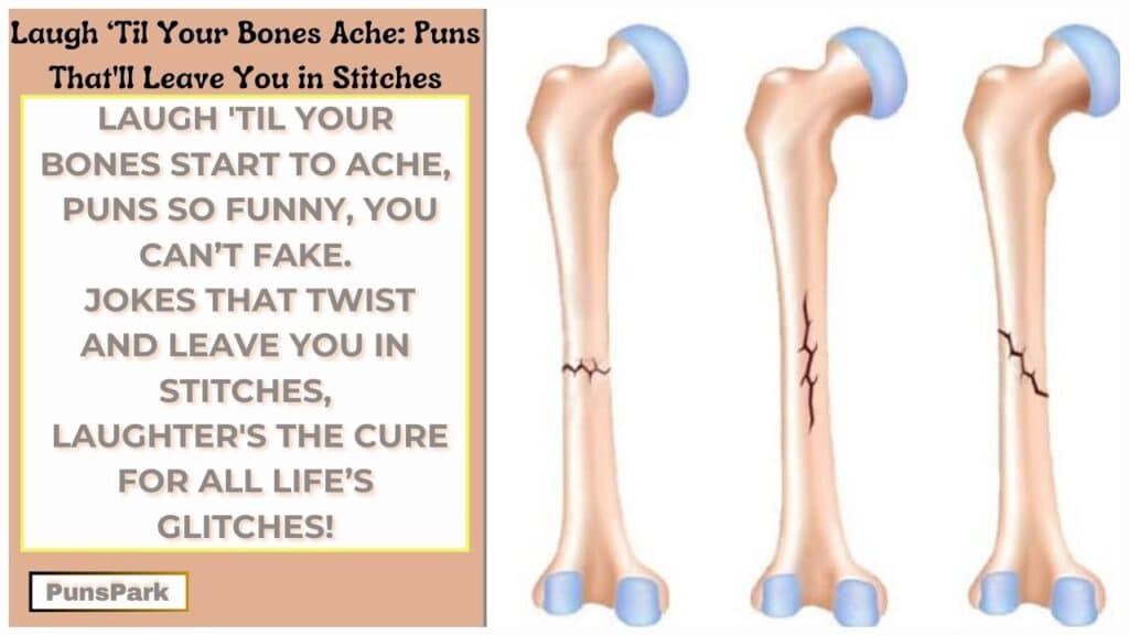 206 Best Bone Puns & Jokes To Tickle Your Funny Bone!